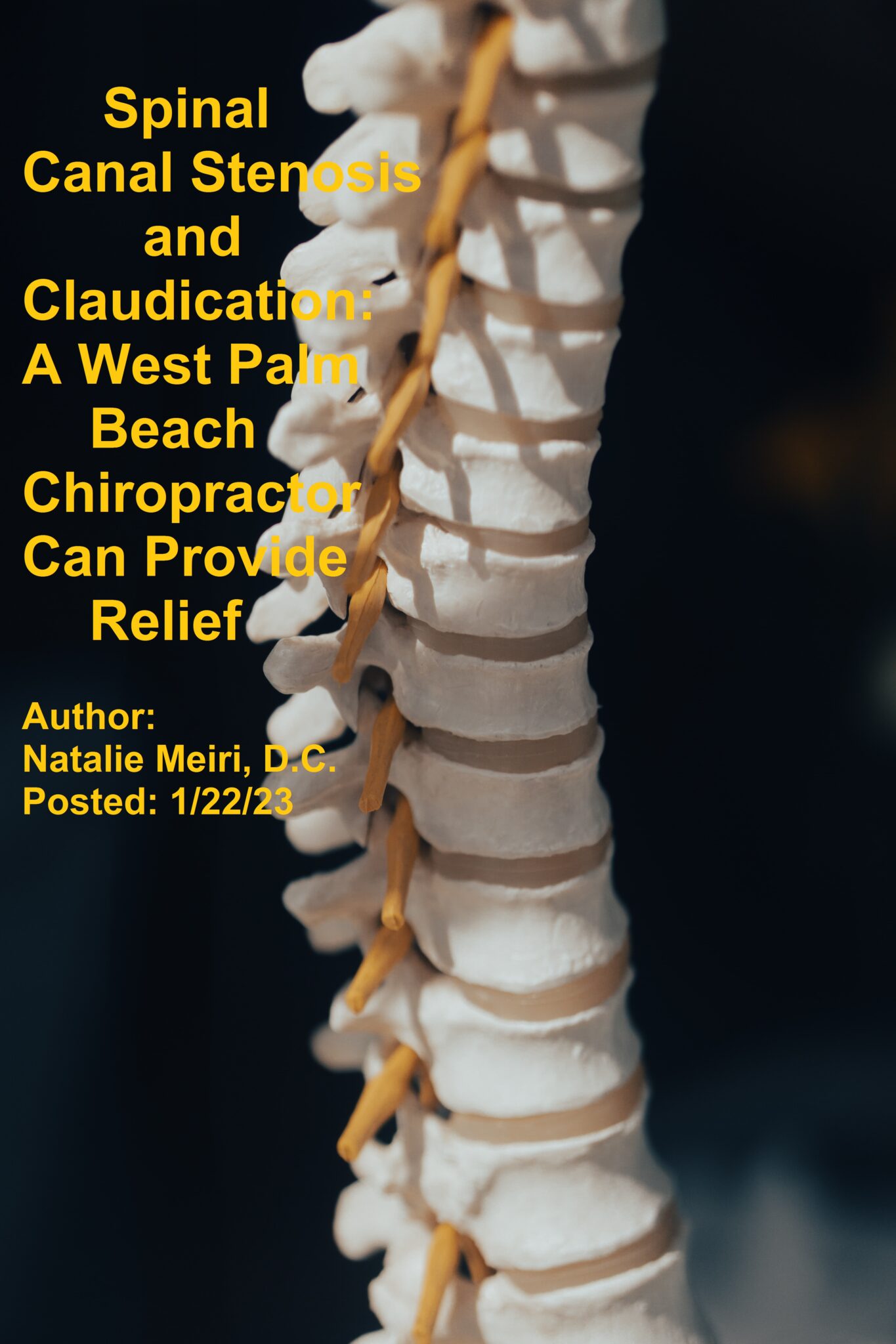 Spinal Canal Stenosis and Claudication : A West Palm Beach Chiropractor ...