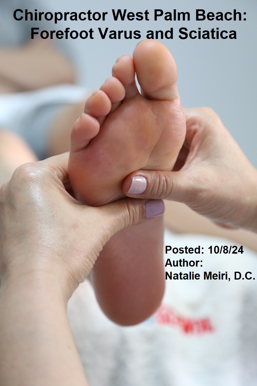 Chiropractor West Palm Beach: Forefoot Varus and Sciatica