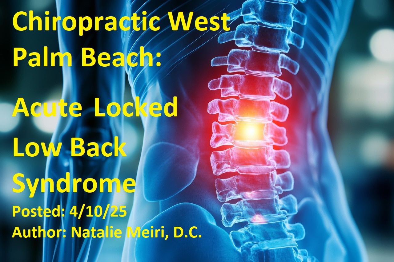 Chiropractic West Palm Beach: Acute Locked Low Back Syndrome