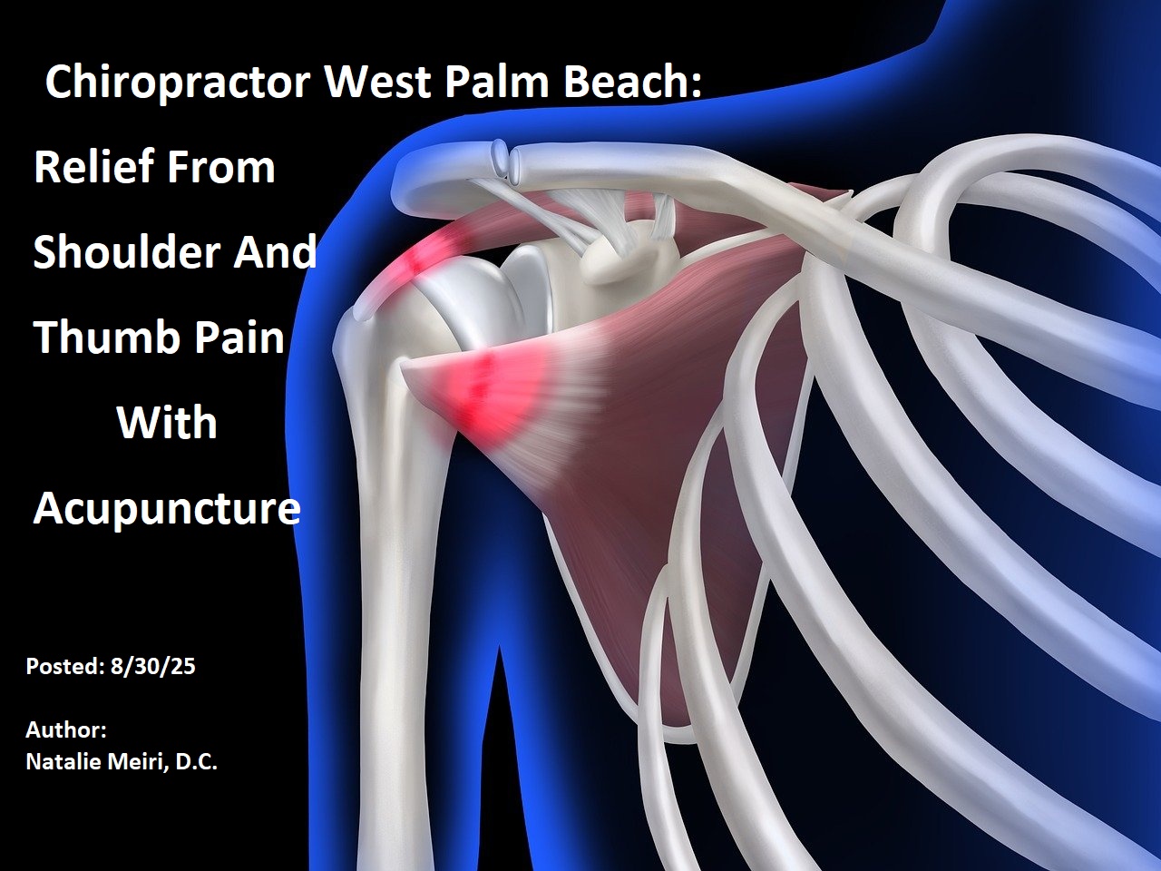 Chiropractor West Palm Beach: Relief From Shoulder And Thumb Pain With ...
